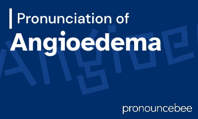 How To Pronounce Angioedema - Correct pronunciation of Angioedema